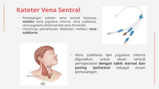 pemasangan monitoring Hemodinamik Invasif | PPT