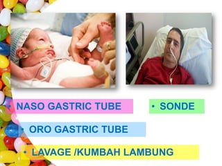 pemenuhan kebutuhan nutrisi melalui pemsangan naso gastric tube | PDF