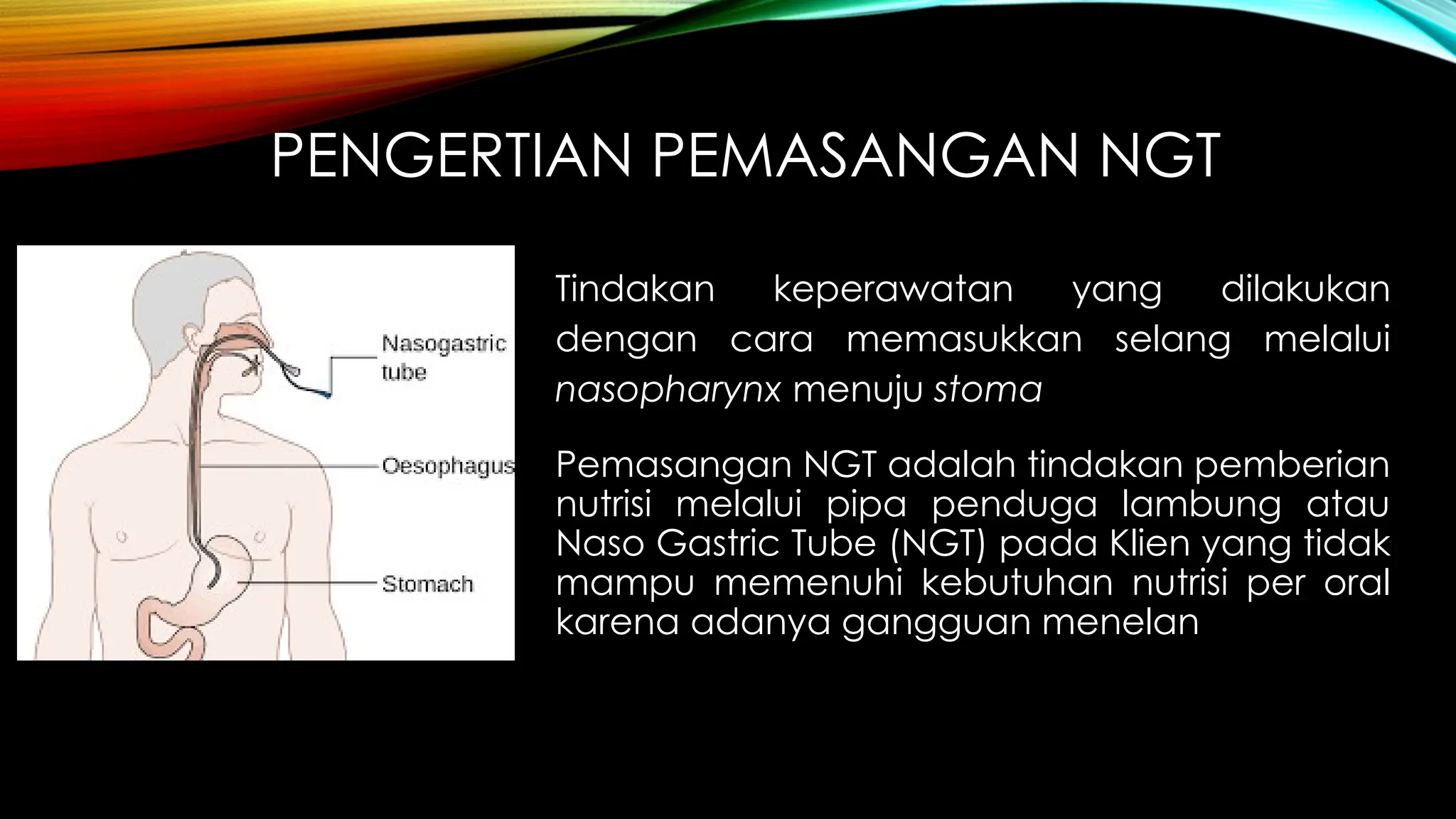 Materi Pemasangan Nasogastric tube (NGT) | PPTX
