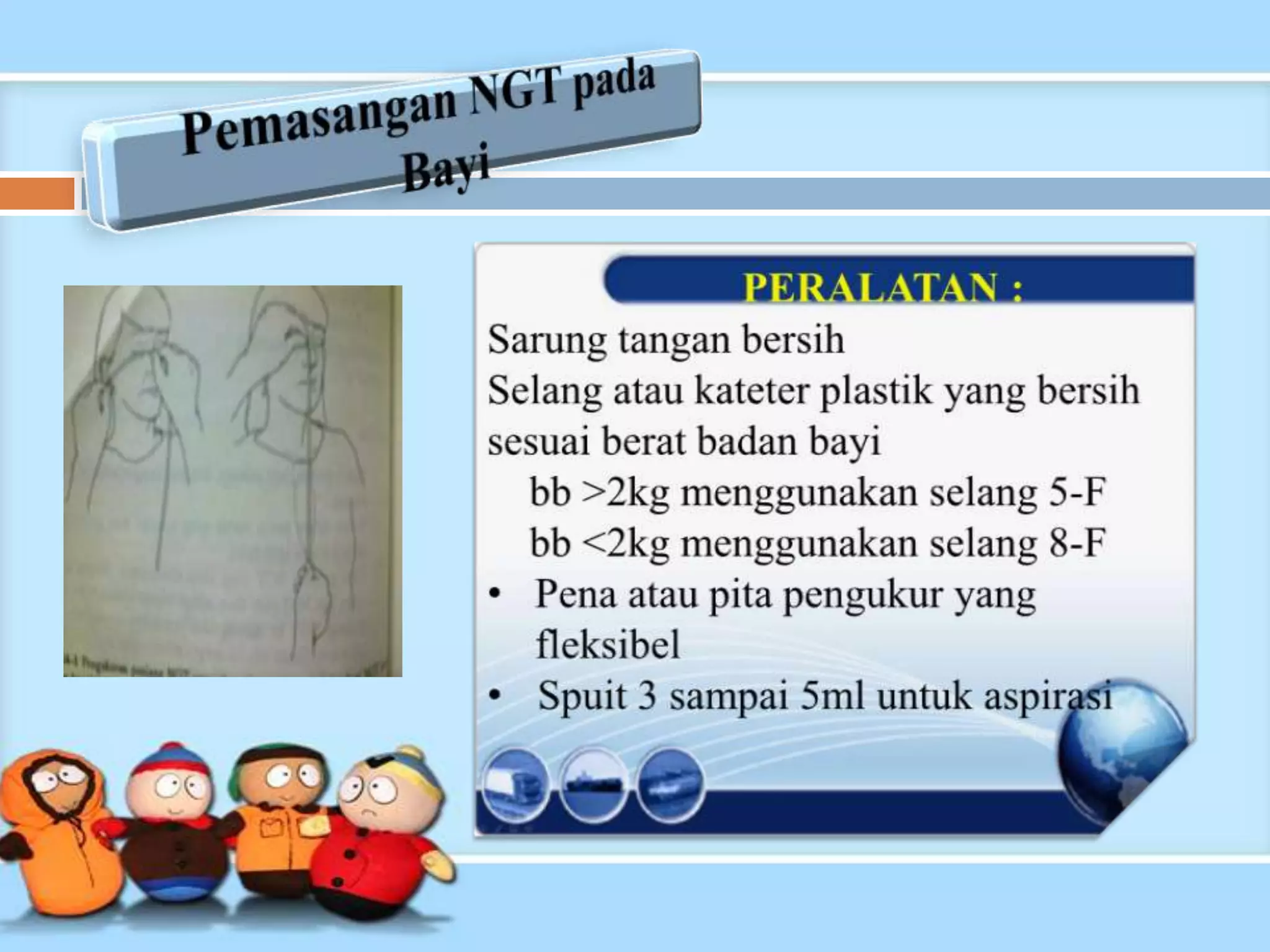 Pemasangan sonde (ngt) pada bayi | PPTX