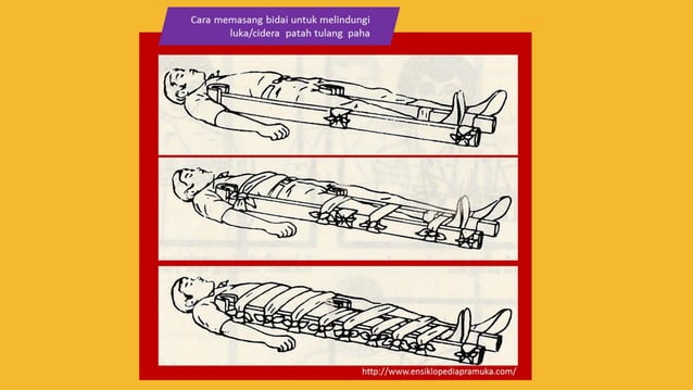 cara melakukan PEMBALUTAN DAN PEMBIDAIAN.pptx