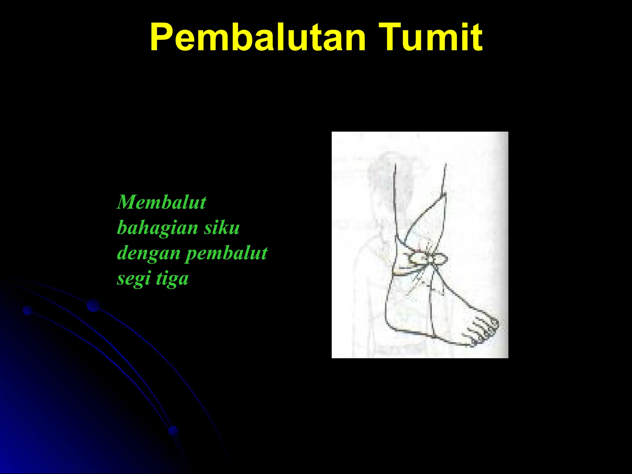 PEMBALUTAN SEGITIGA BAGI TUJUAN BALUTAN PESAKIT..ppt