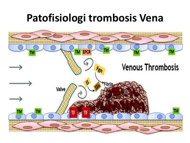 GANGGUAN PEREDARAN DARAH PERIFER