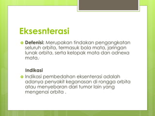 Pembedahan pada mata | PPTX