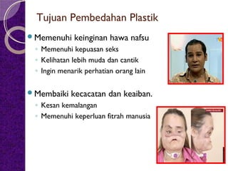 Pembedahan plastik dan jantina | PPT