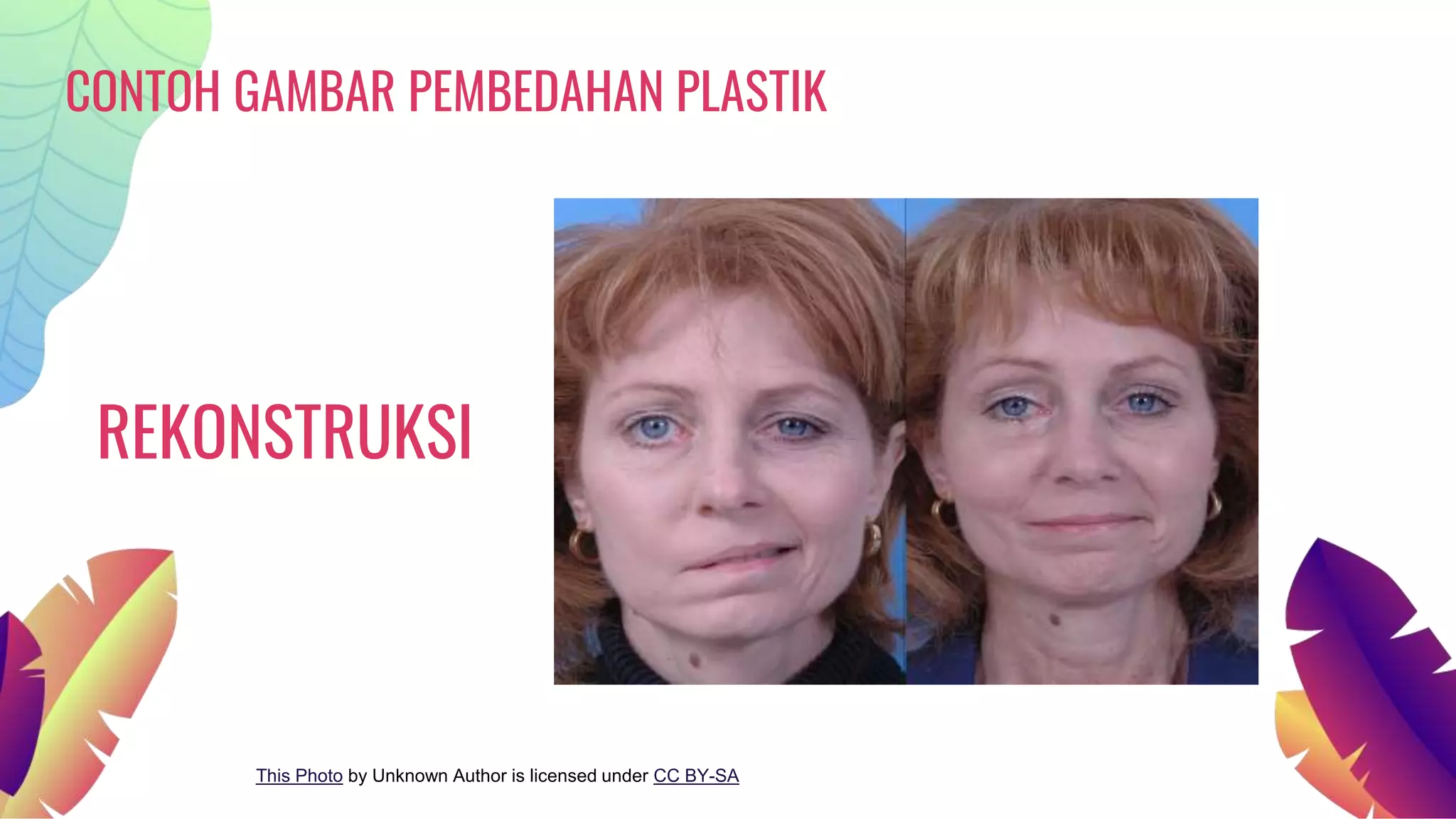 Pembedahan plastik dan rawatan estetik ctu211 | PPTX