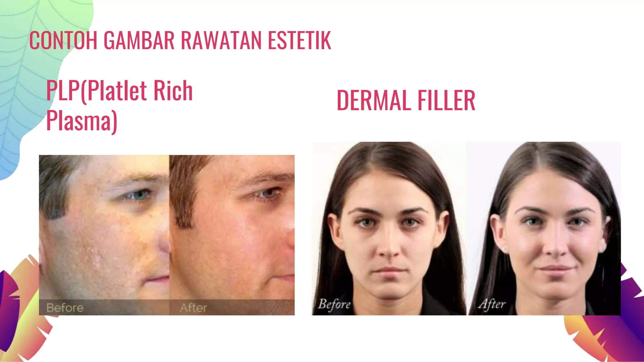 Pembedahan plastik dan rawatan estetik ctu211 | PPTX