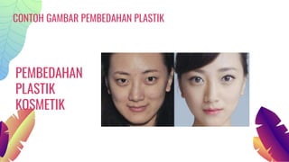 Pembedahan plastik dan rawatan estetik ctu211 | PPT