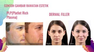 Pembedahan plastik dan rawatan estetik ctu211 | PPT