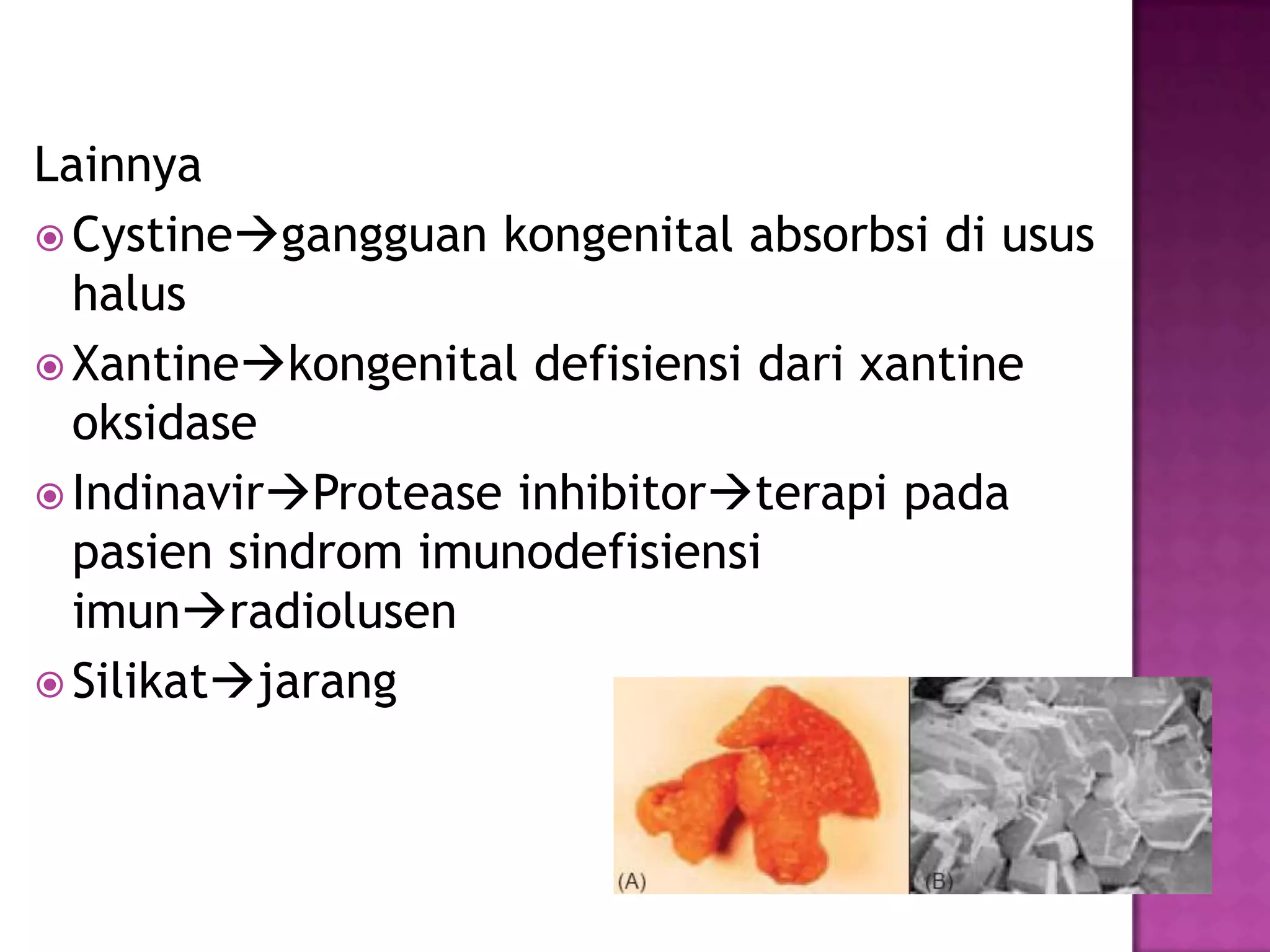 Pembentukan batu kemih 2013 | PPT