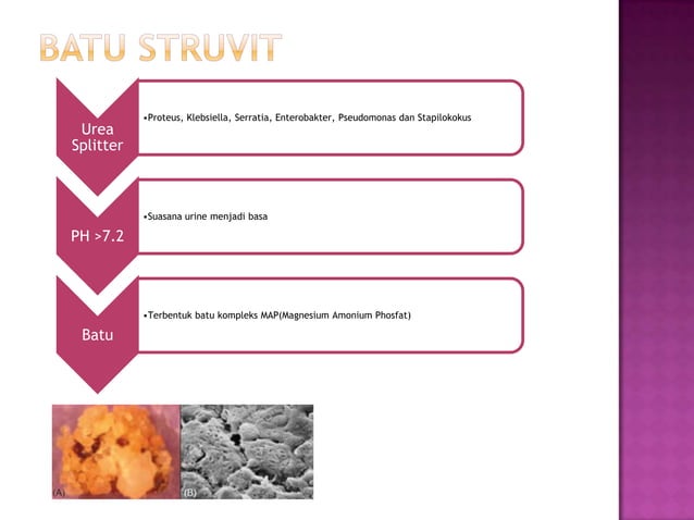 Pembentukan batu kemih 2013 | PPT