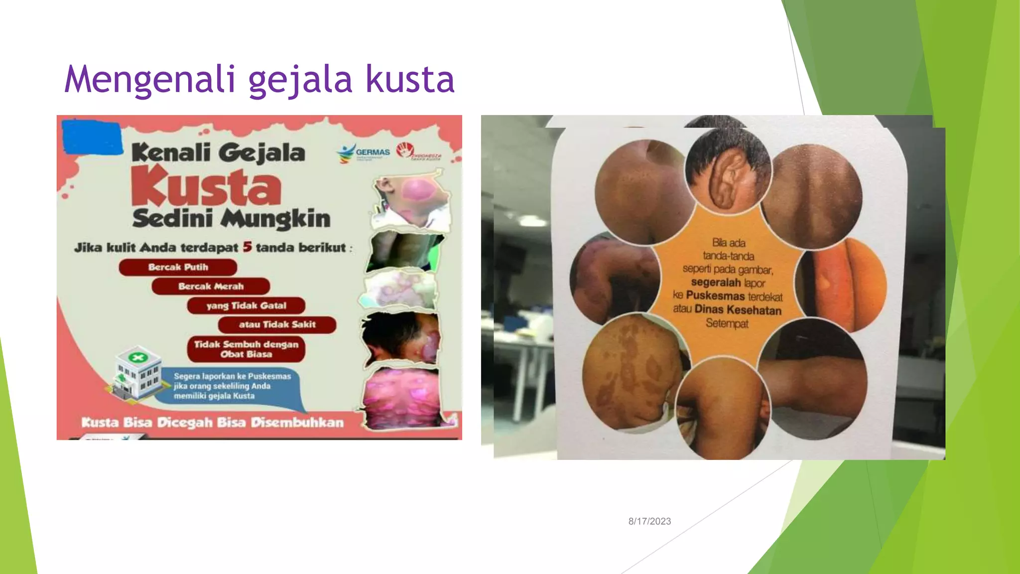 pemberdayaan Kader malaria -TB-Dan-Kusta.ppt