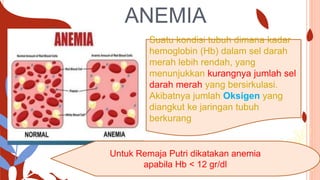 PEMBERIAN TTD DALAM UPAYA PENCEGAHAN ANEMIA PADA REMATRI.pptx
