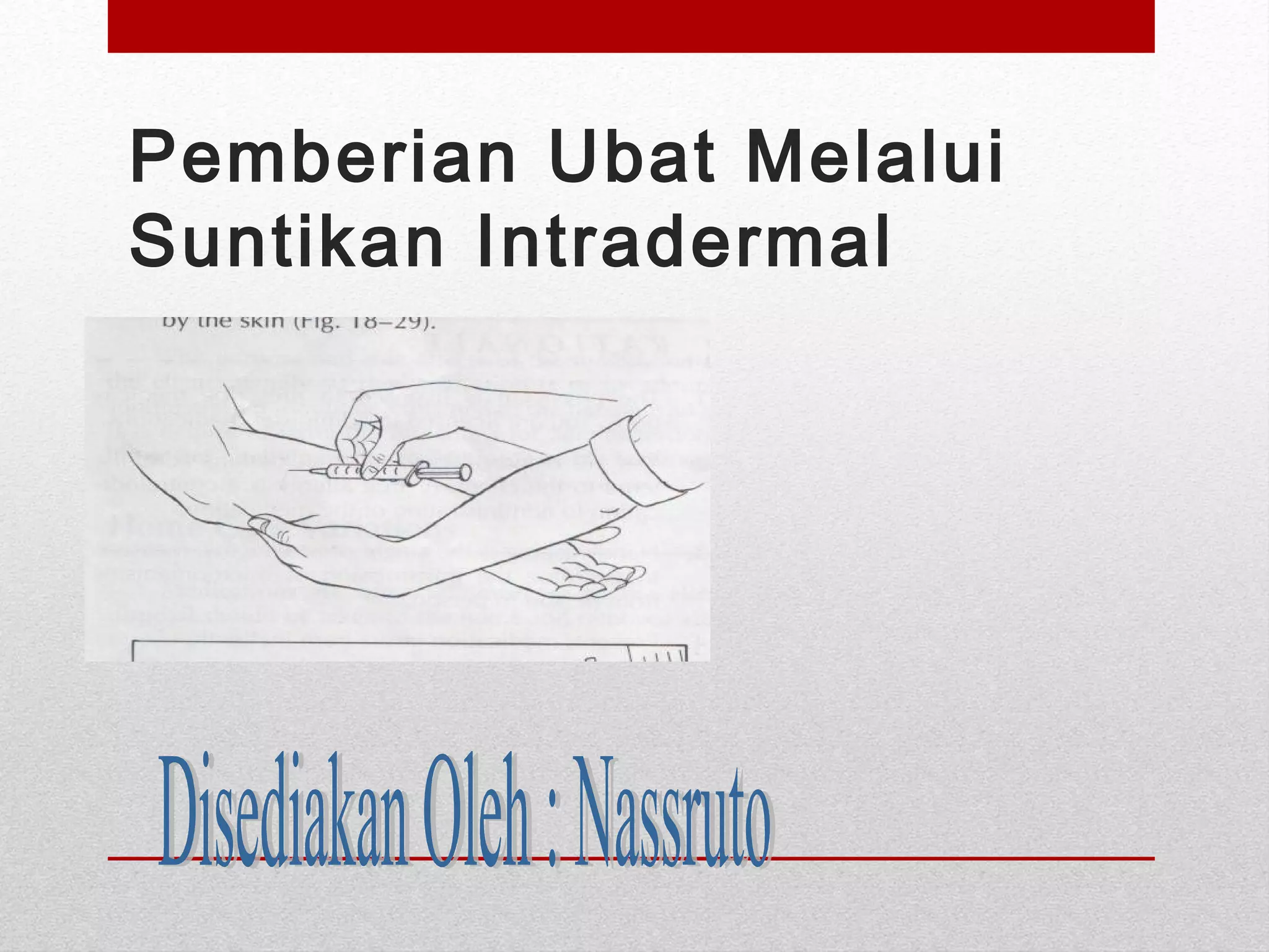 Pemberian Ubat Melalui Suntikan Intradermal | PPT