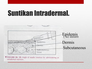 Pemberian Ubat Melalui Suntikan Intradermal | PPT