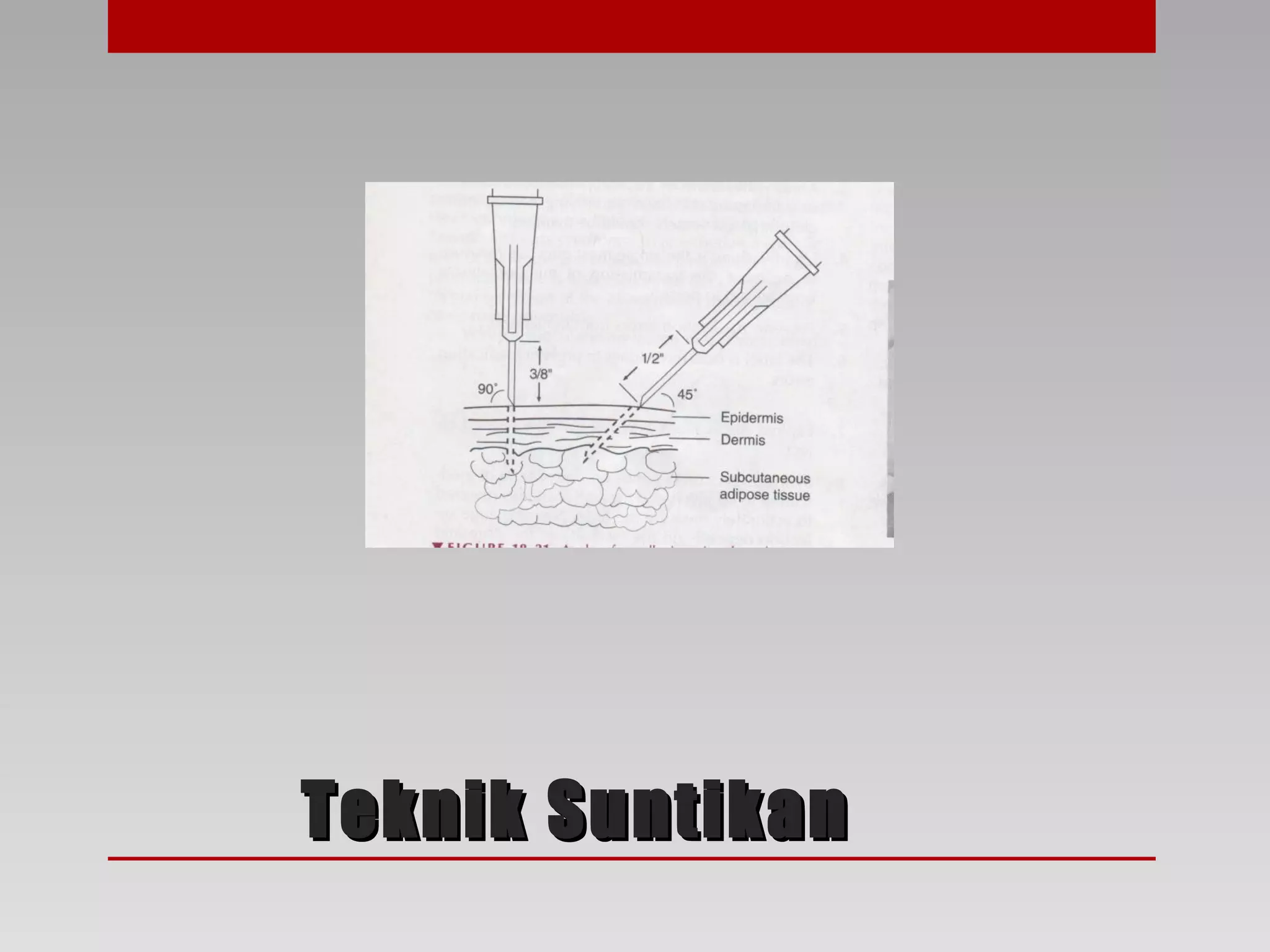 Pemberian Ubat Parenteral - Suntikan | PPT