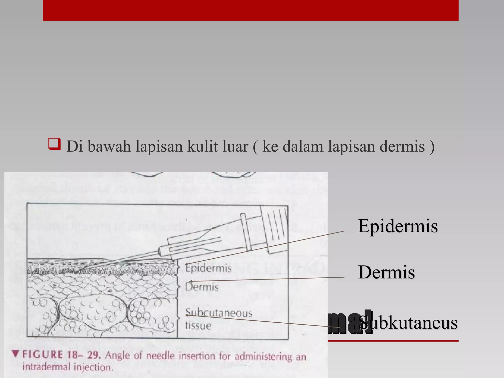 Pemberian Ubat Parenteral - Suntikan | PPT