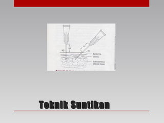 Pemberian Ubat Parenteral - Suntikan | PPT
