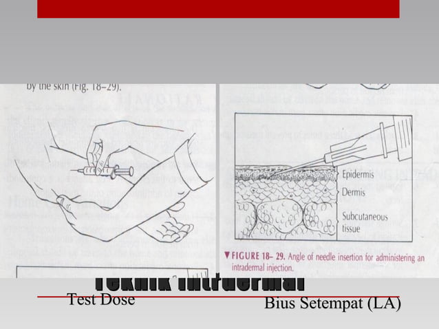 Pemberian Ubat Parenteral - Suntikan | PPT