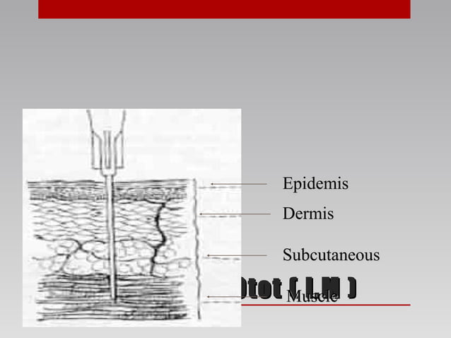 Pemberian Ubat Parenteral - Suntikan | PPT