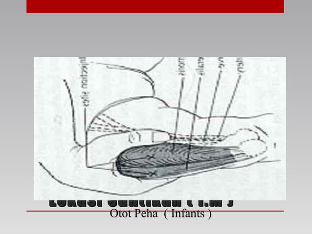 Pemberian Ubat Parenteral - Suntikan | PPT