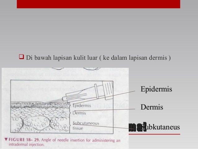 Ubat Tisu Otot Koyak - Kuching n