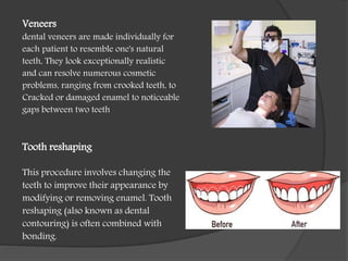 Cosmetic Dentistry - Pembridge Dental | PPT