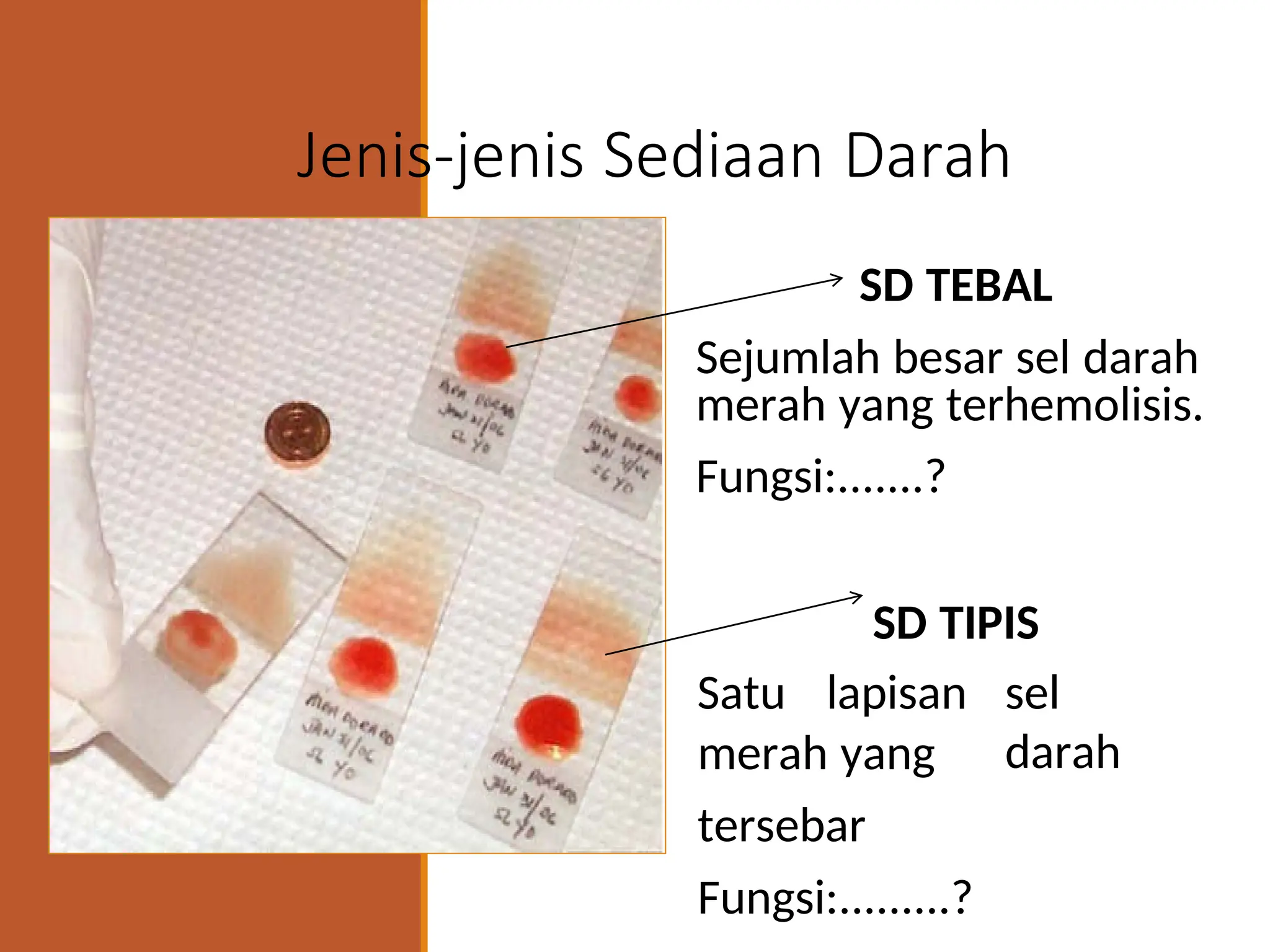 Pembuatan Sediaan Darah MalariaLABORATORIUM MALARIA | PPT