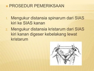 Pemeriksaan panggul luar | PPTX