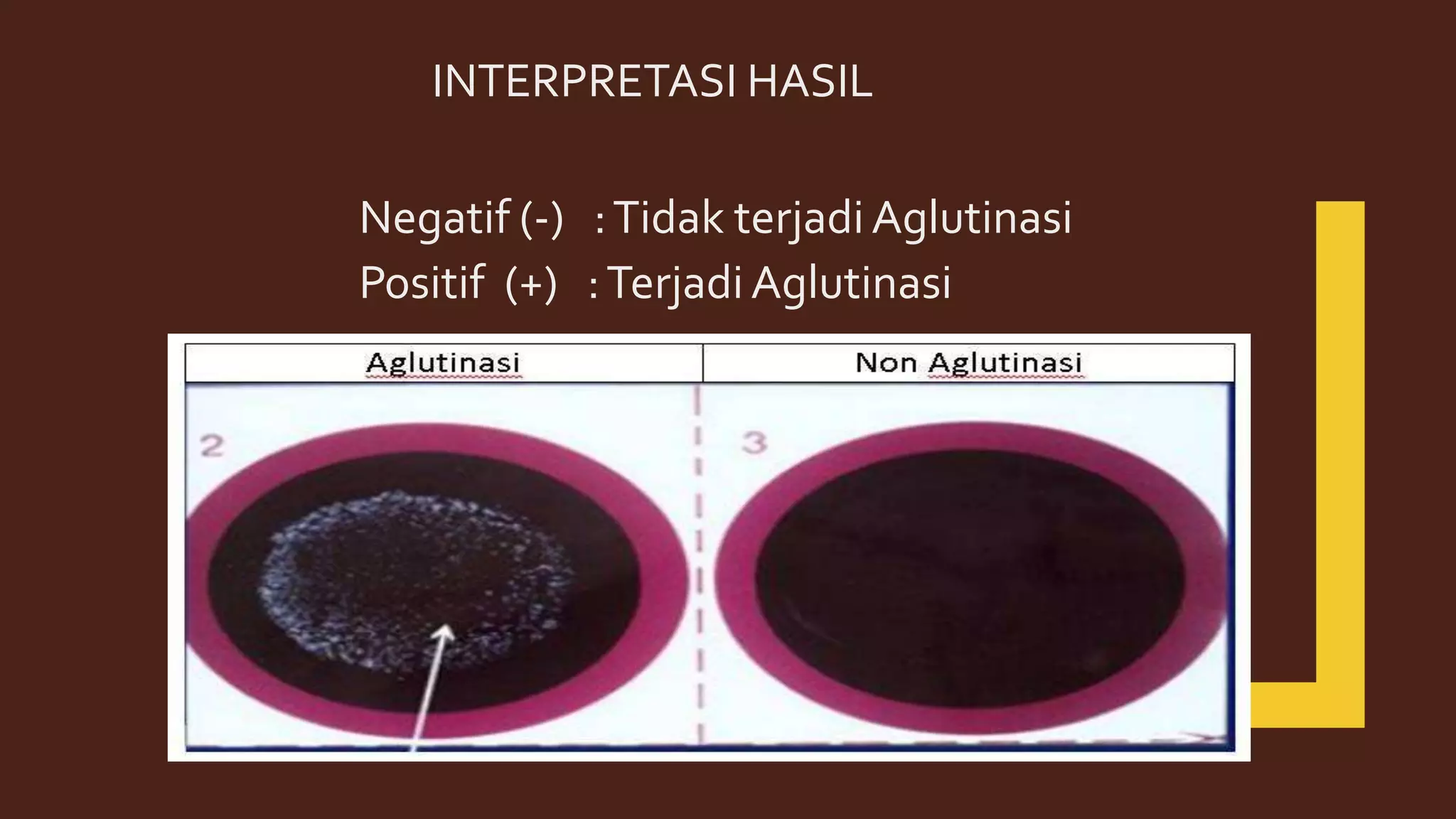 Pemeriksaan anti sterptolisyn (asto) xi tlm | PPTX