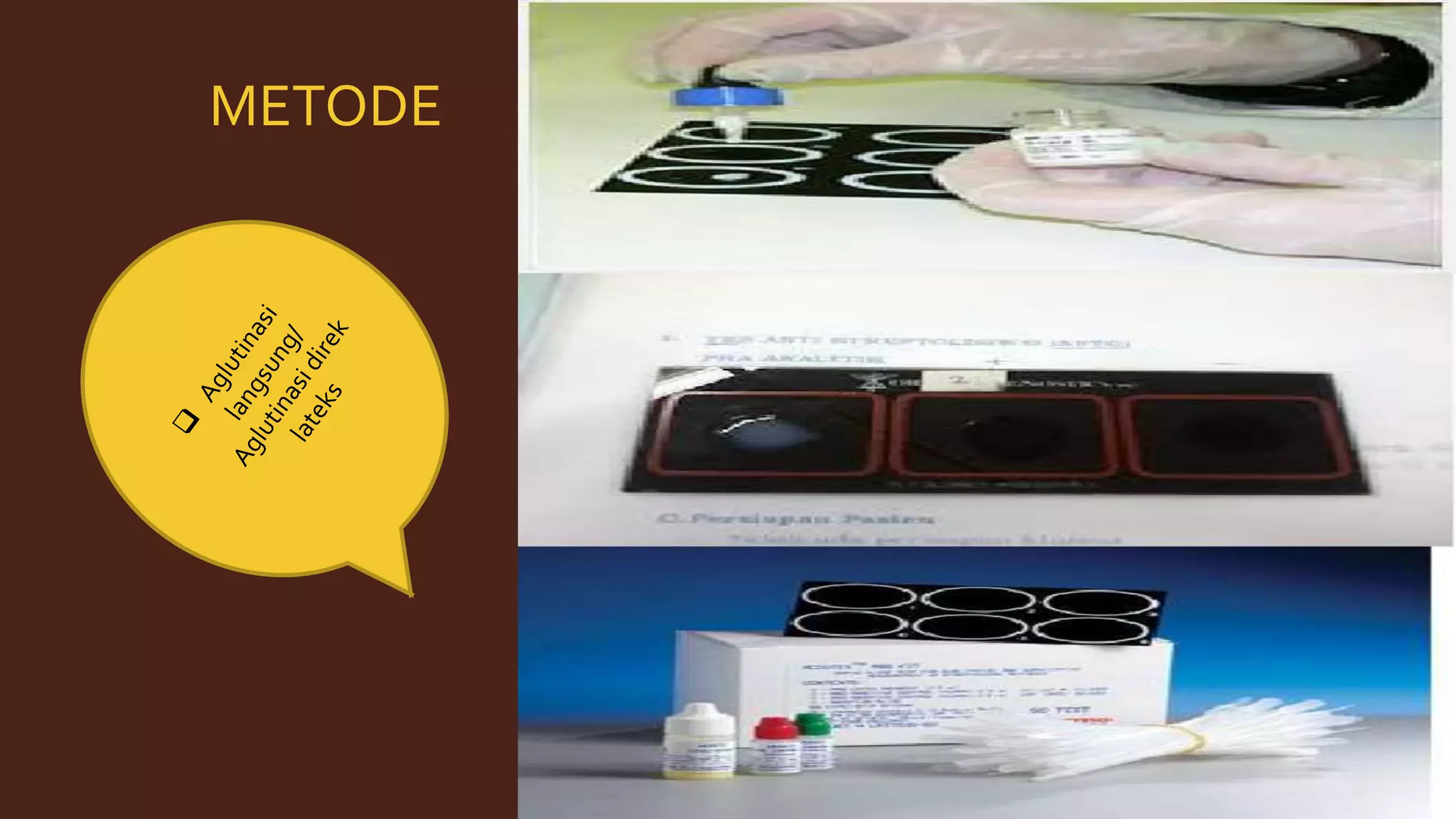 Pemeriksaan anti sterptolisyn (asto) xi tlm | PPTX