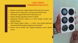 Pemeriksaan anti sterptolisyn (asto) xi tlm | PPTX