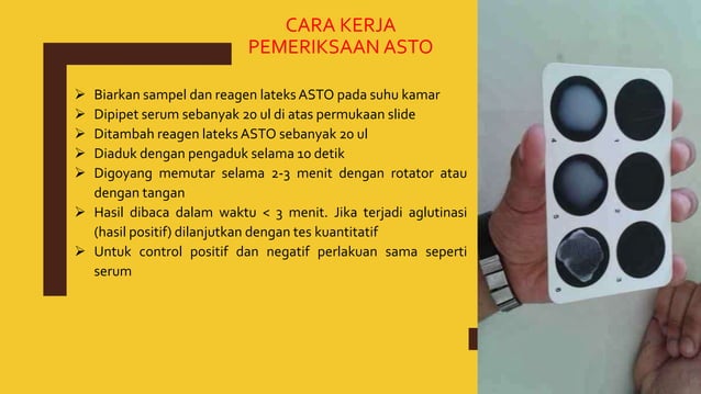 Pemeriksaan anti sterptolisyn (asto) xi tlm | PPTX