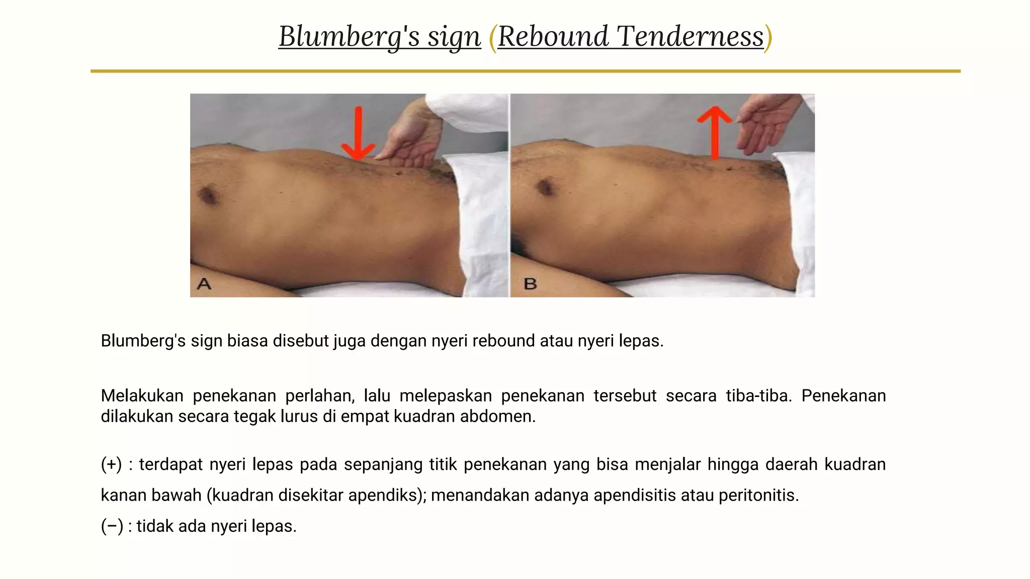 PEMERIKSAAN (APENDISITIS & SCHUFFNER) fixx.pptx