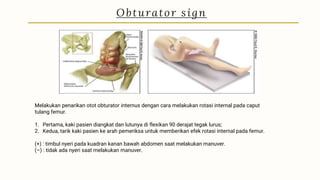 PEMERIKSAAN (APENDISITIS & SCHUFFNER) fixx.pptx