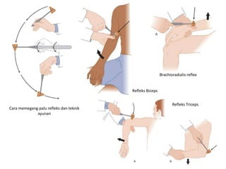 Pemeriksaan Columna Vertebralis dan Fungsi Luhur.pptx