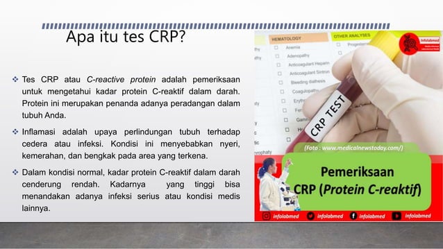 Pemeriksaan (crp) xii tlm | PPTX