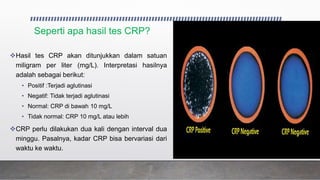Pemeriksaan (crp) xi tlm | PPTX