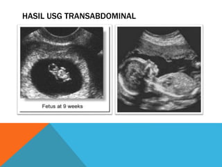 Pemeriksaan diagnostik | PPTX