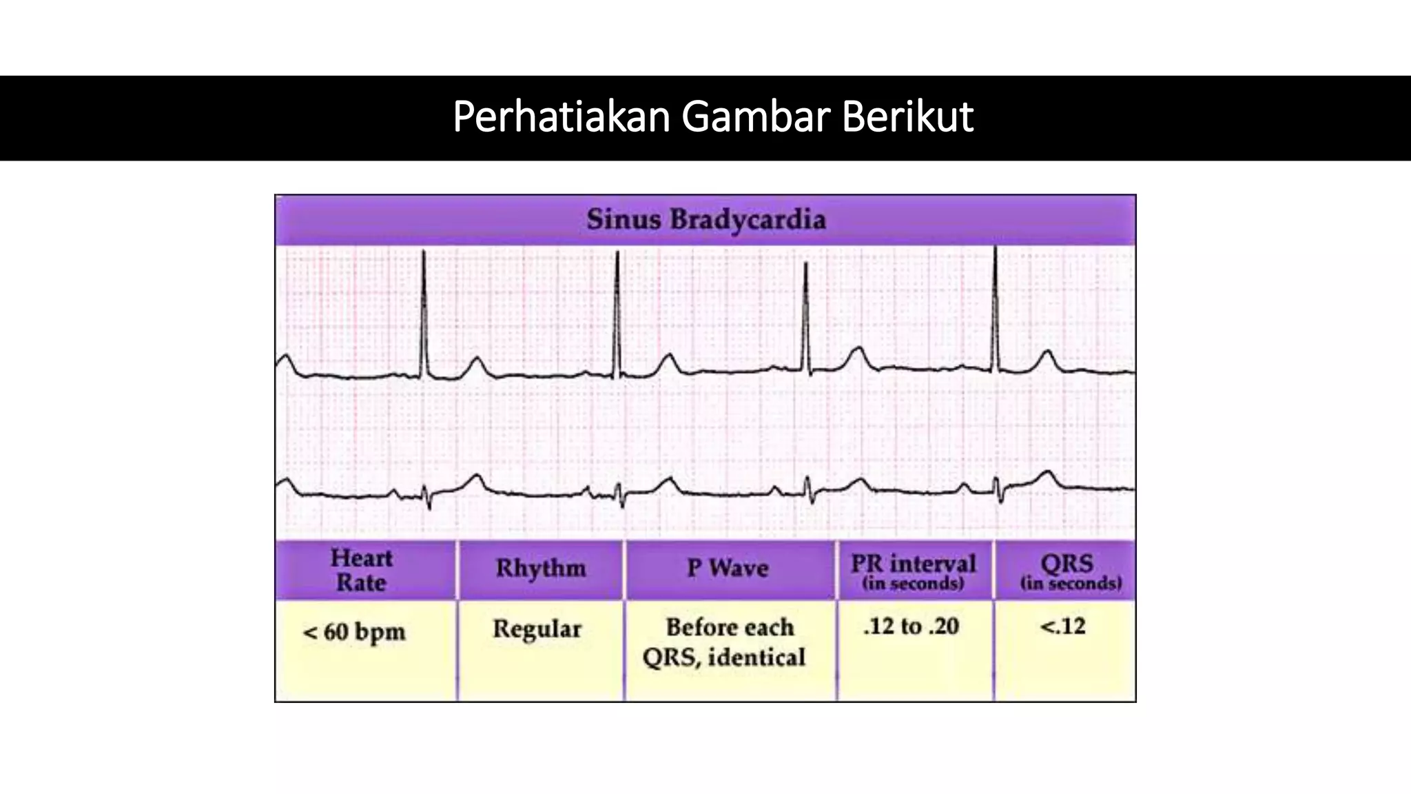 Pemeriksaan EKG.pptx