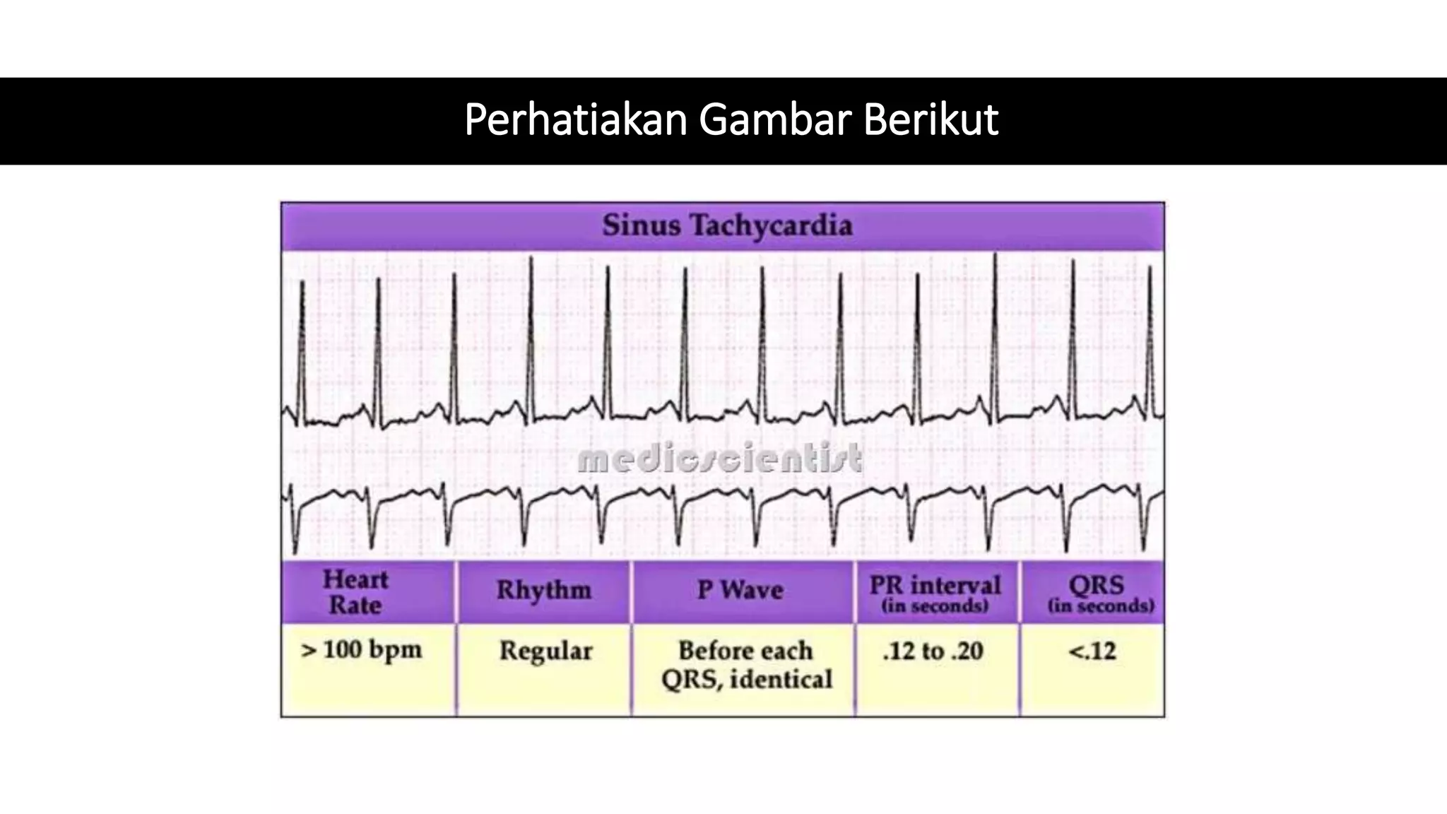 Pemeriksaan EKG.pptx