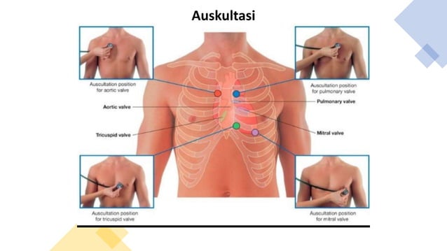 Pemeriksaan EKG.pptx | Free Download