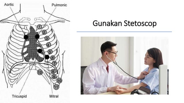 Pemeriksaan EKG.pptx | Free Download
