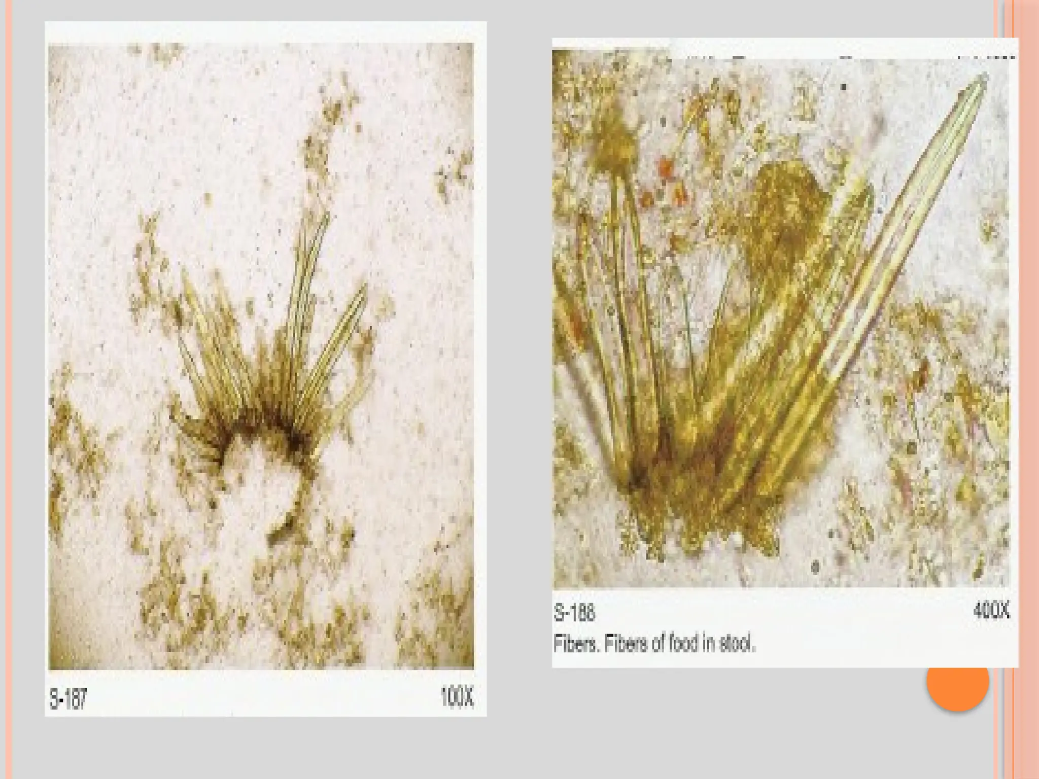 PEMERIKSAAN FESES.pptx PEMERIKSAAN FESES.pptx