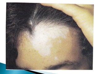 konsep dasar Pemeriksaan fisik, Herianto,Skep,Ns | PPTX