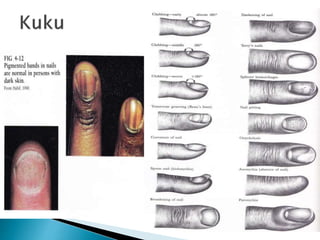 konsep dasar Pemeriksaan fisik, Herianto,Skep,Ns | PPT