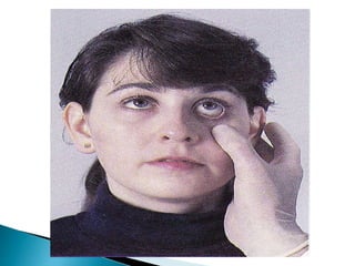 konsep dasar Pemeriksaan fisik, Herianto,Skep,Ns | PPTX