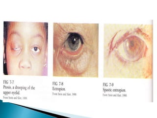 konsep dasar Pemeriksaan fisik, Herianto,Skep,Ns | PPTX