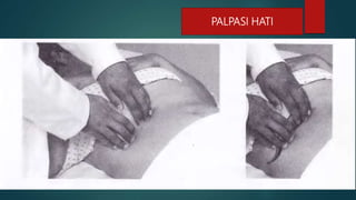 Pemeriksaan fisik abdomen | PPTX