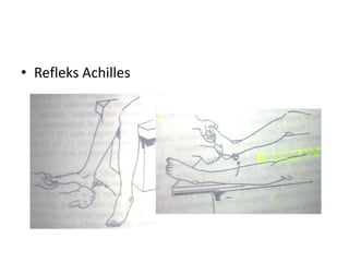 Pemeriksaan Fisik Abdomen_Ni Kadek Yuni L | PPTX